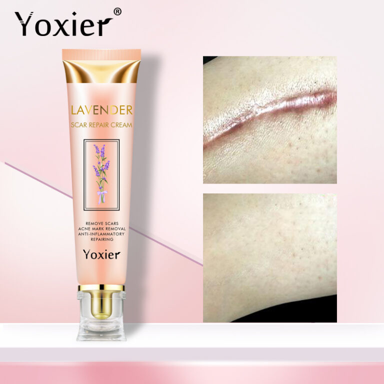 Yoxier Lavender Scar Repair... - KM Goods
